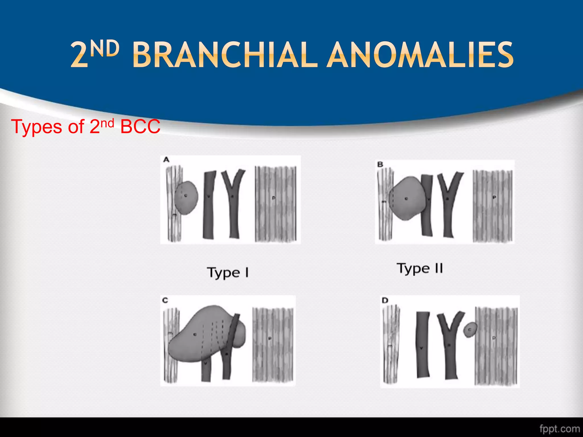 Branchial anomalies | PPTX