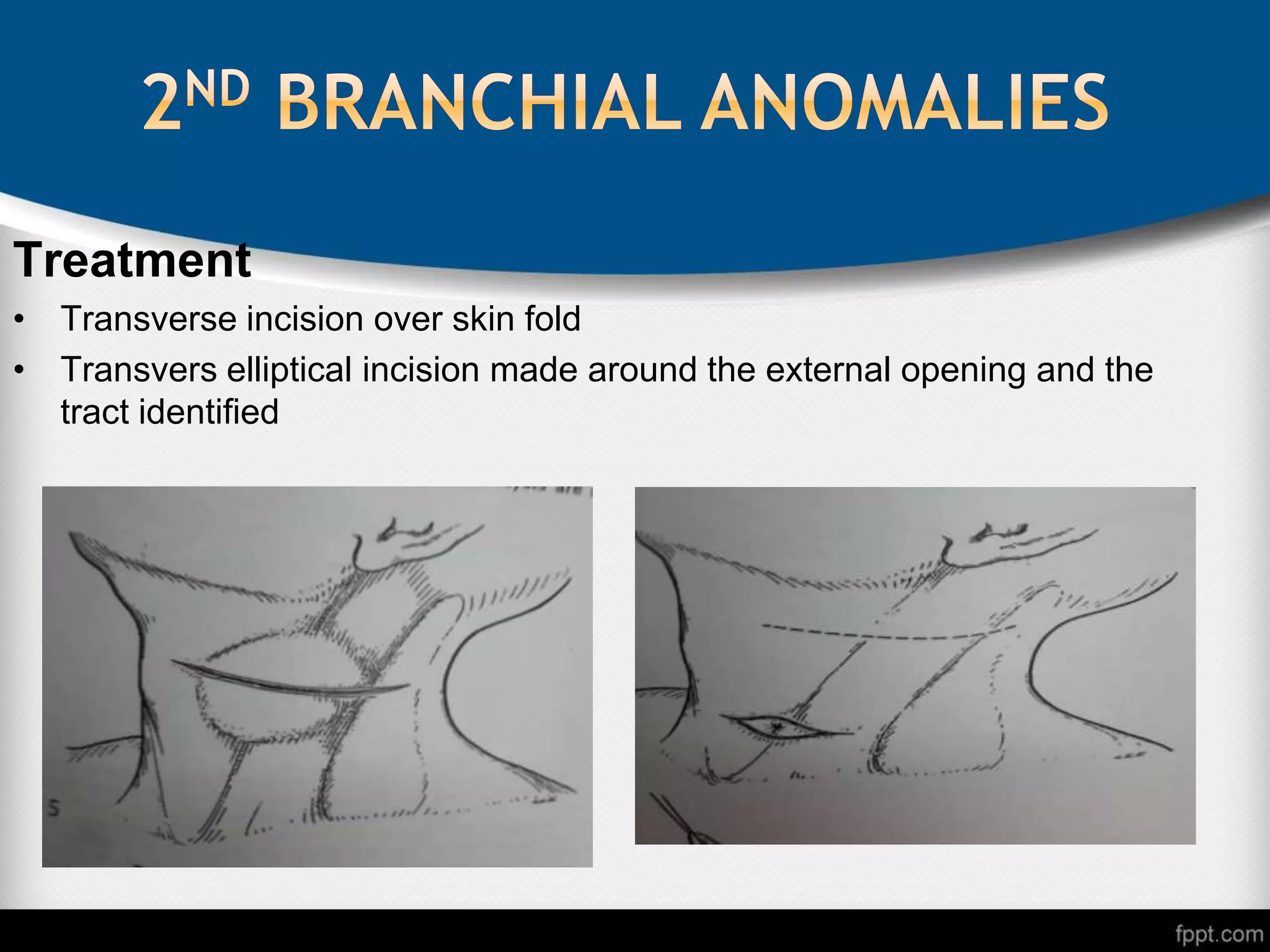 Branchial anomalies | PPTX