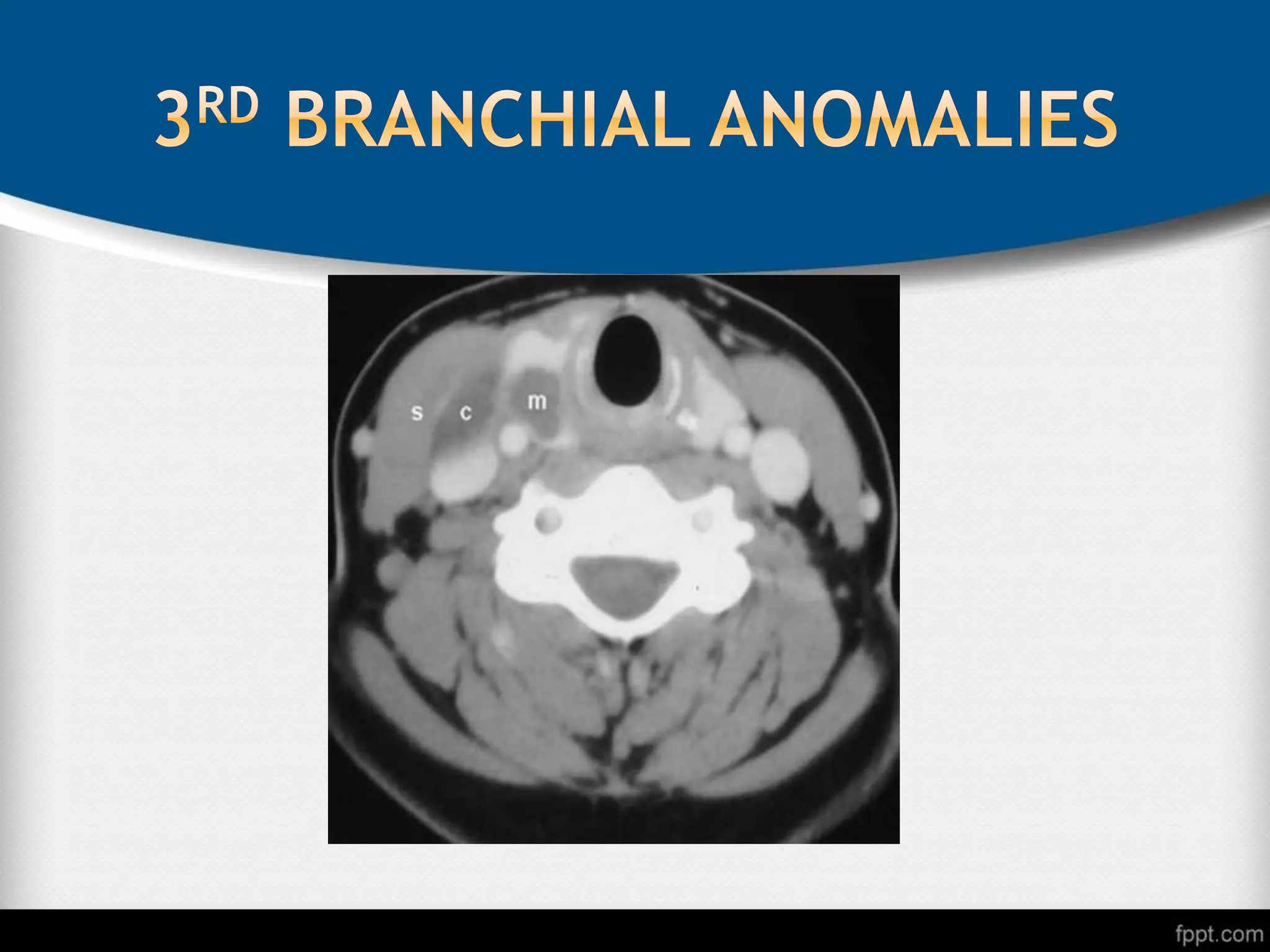 Branchial anomalies | PPTX