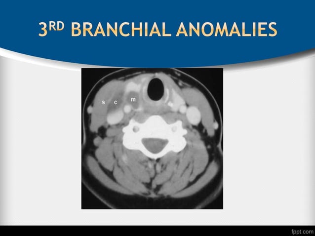 Branchial anomalies | PPTX