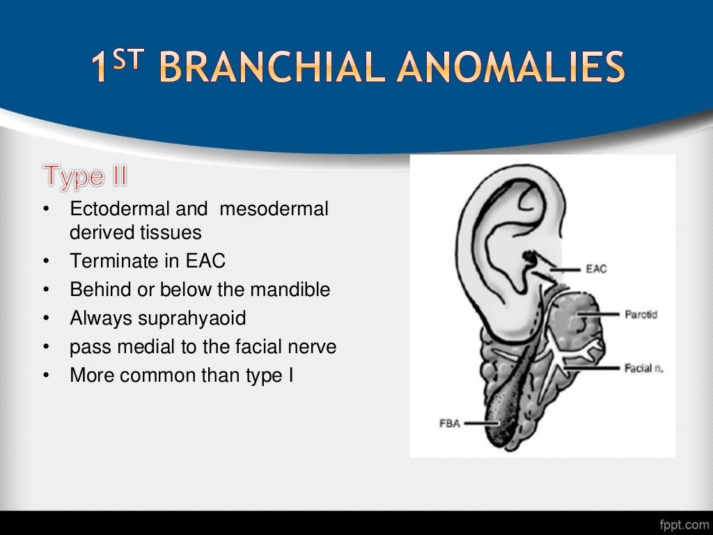 Branchial anomalies