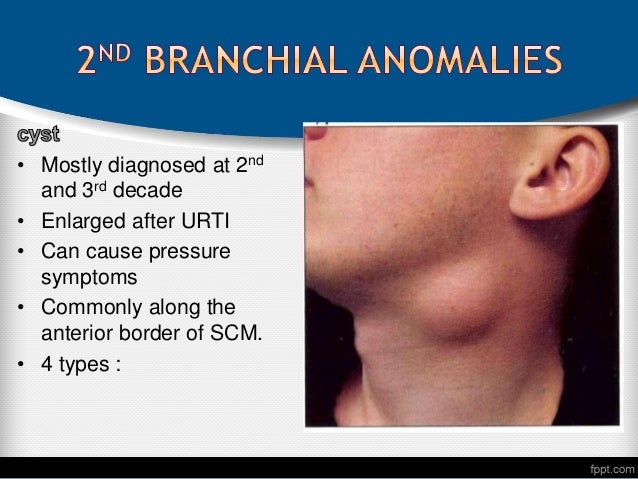 Branchial anomalies