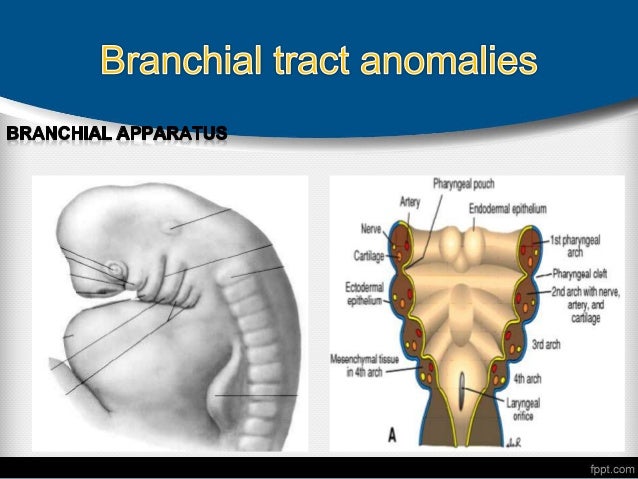 Branchial anomalies