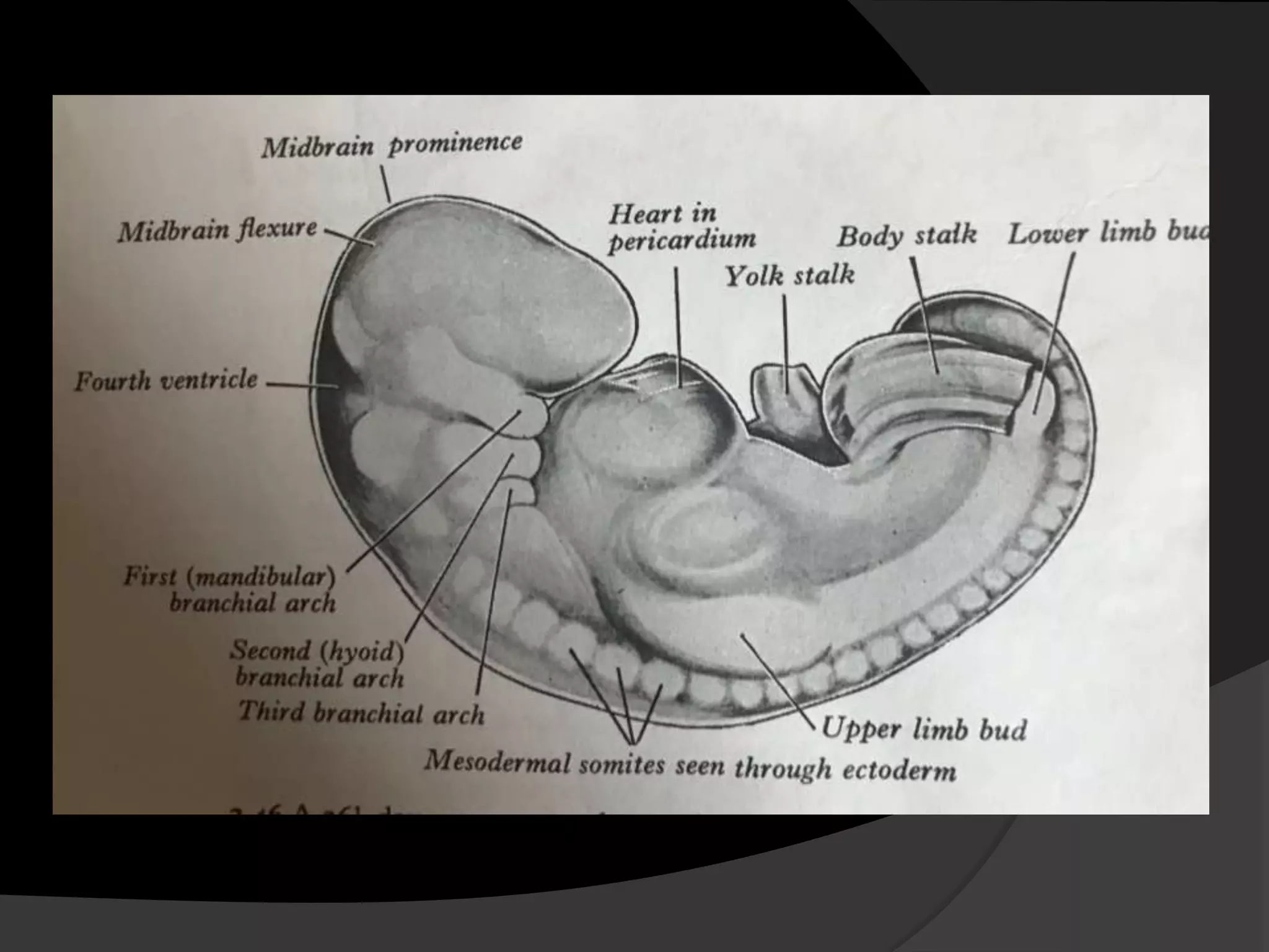 Branchial arches | PPTX