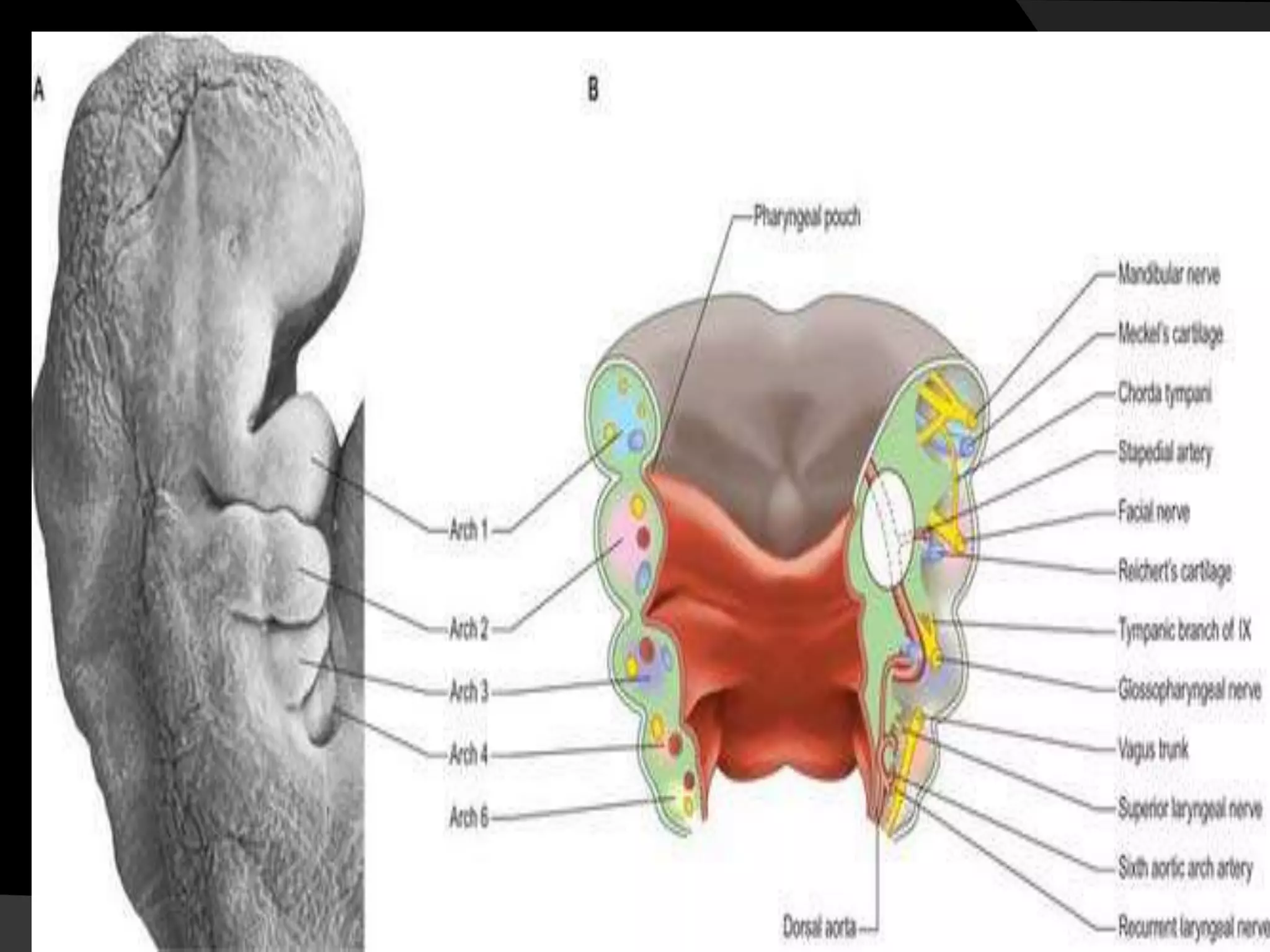 Branchial arches | PPTX