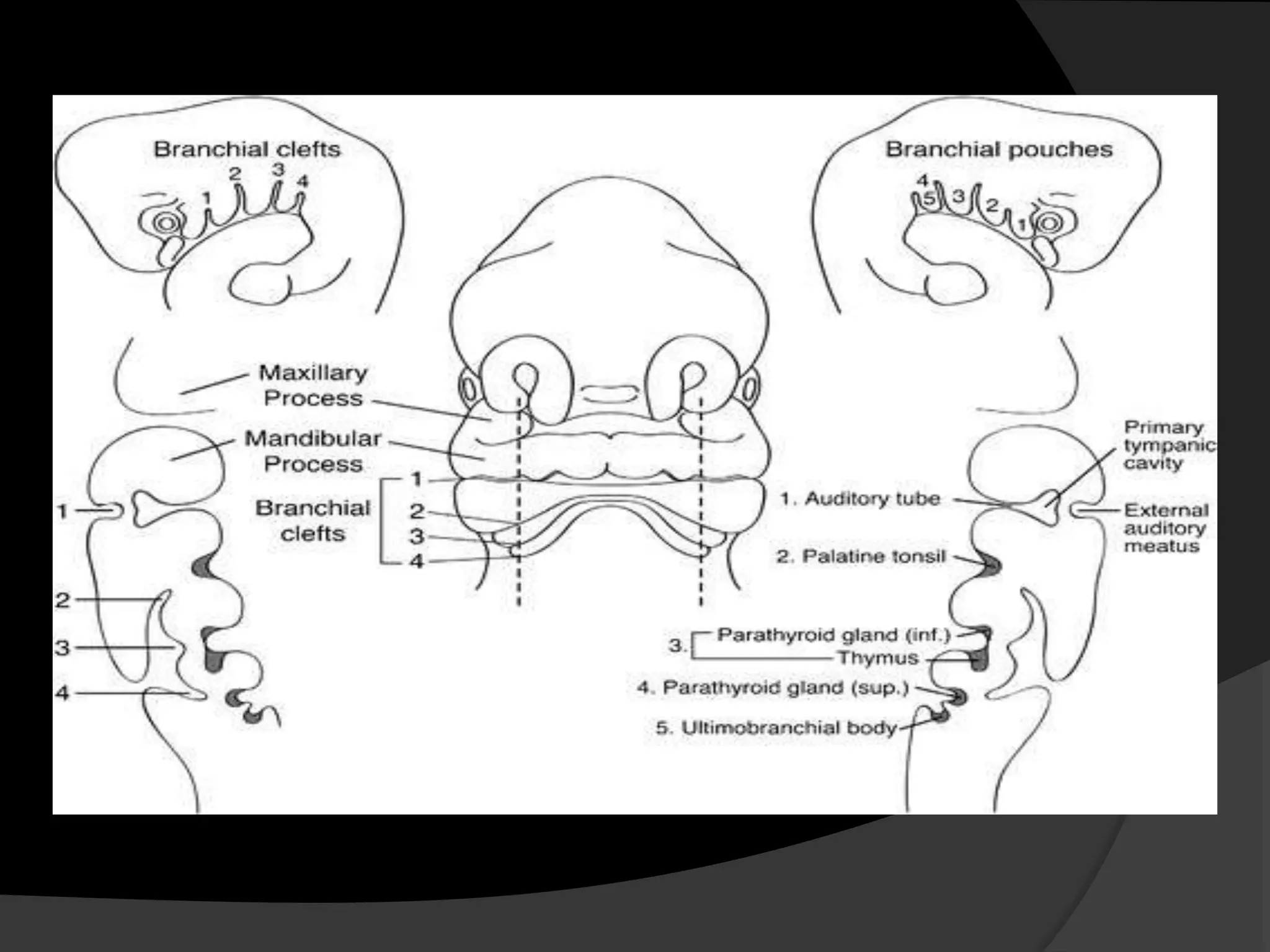 Branchial arches | PPTX