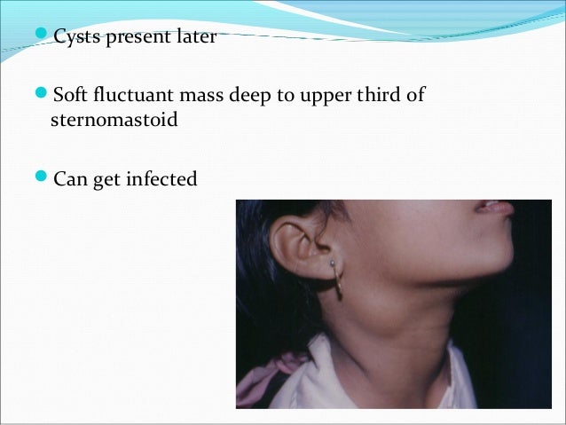 Branchial Cyst And Thyroglossal Cyst