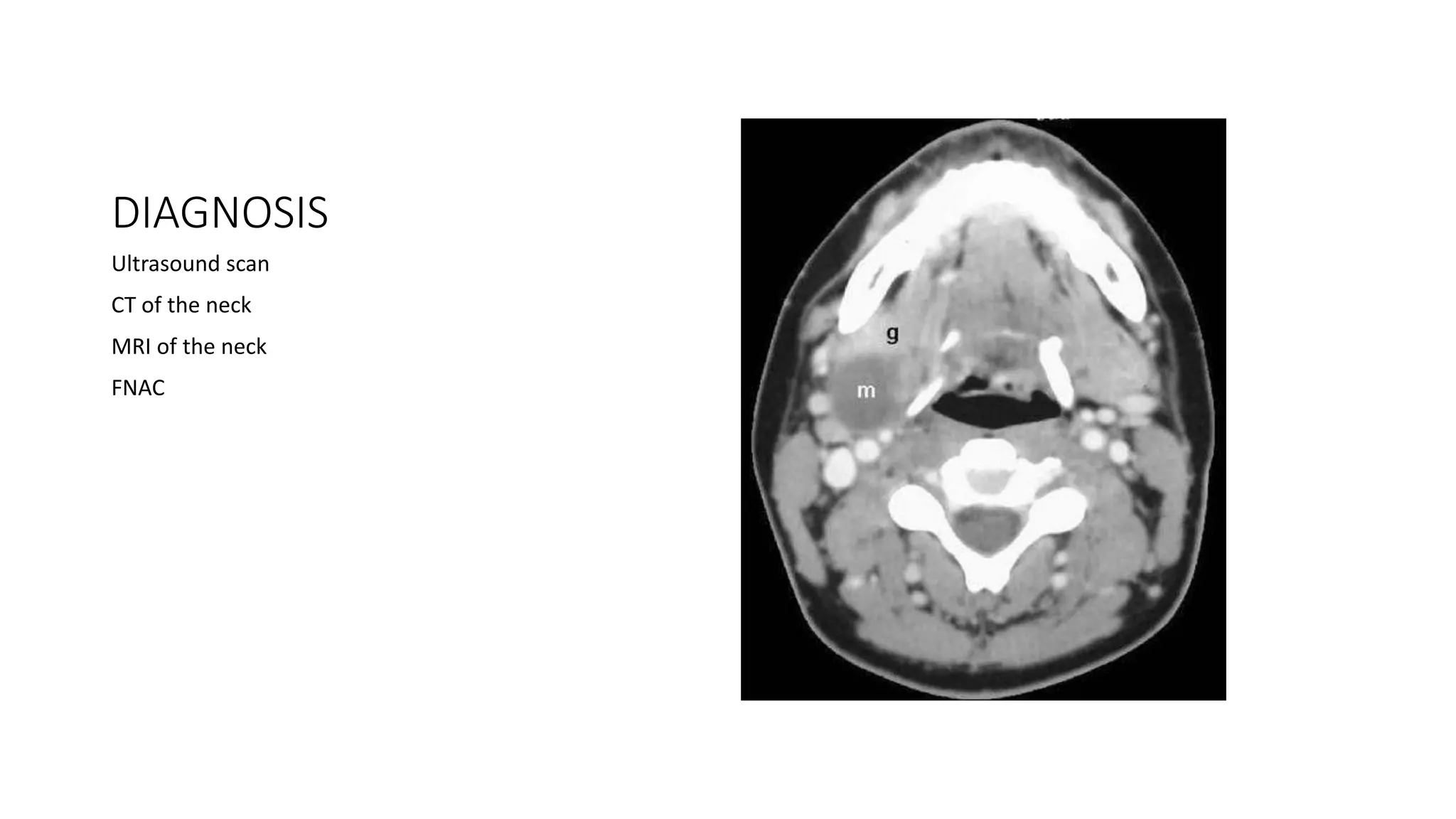 BRANCHIAL CYSTS et.pptx