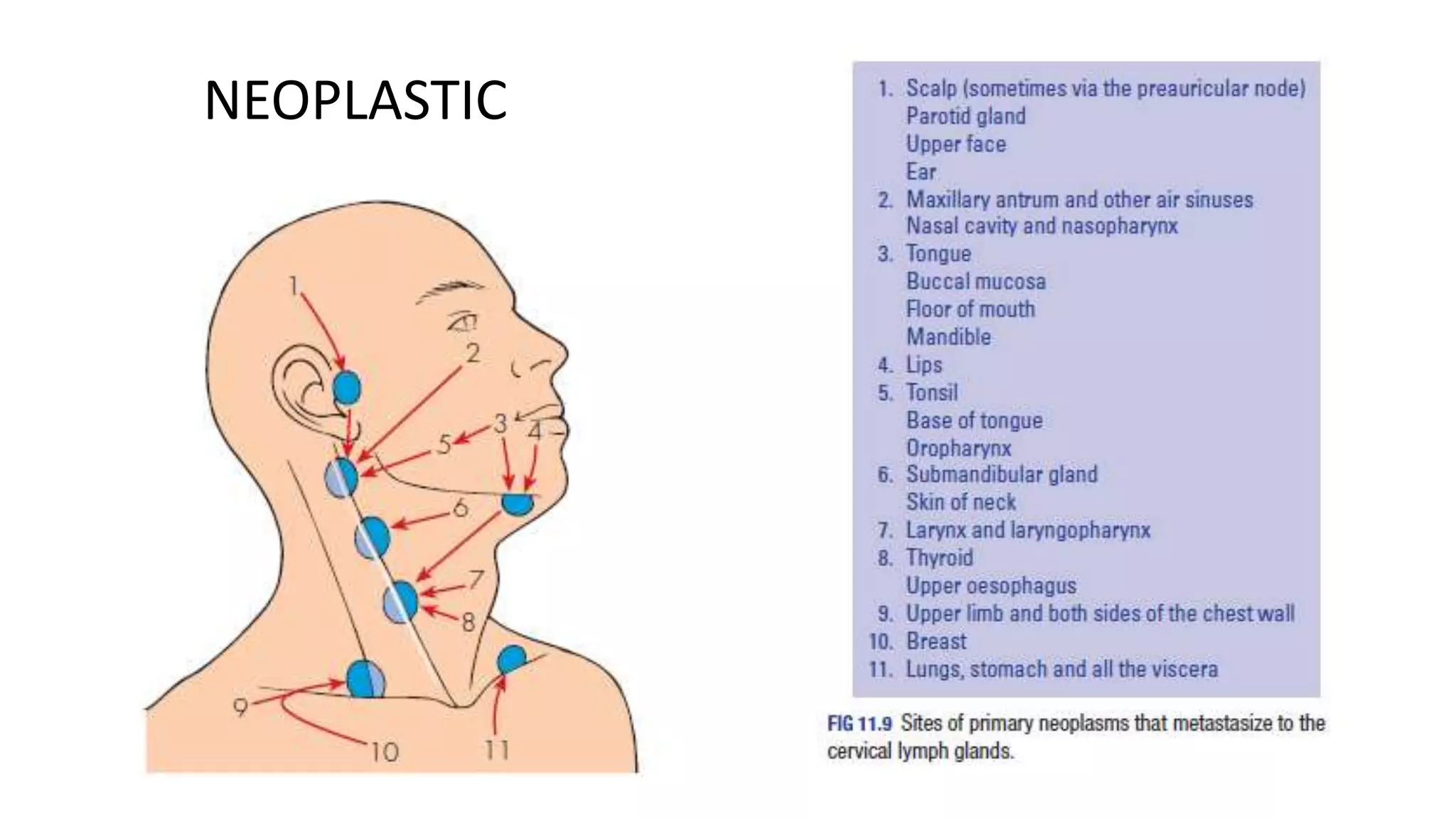 BRANCHIAL CYSTS et.pptx