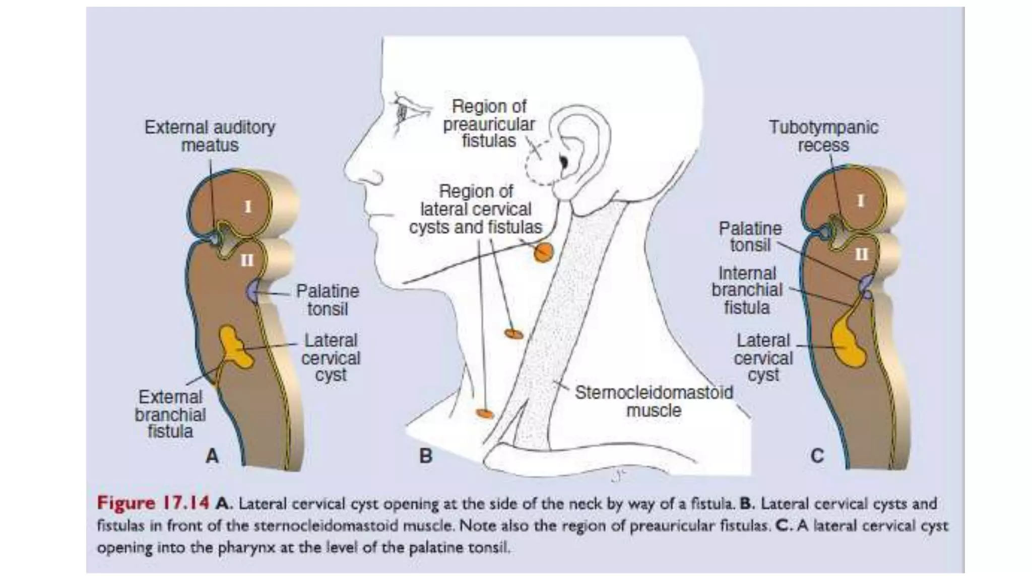 BRANCHIAL CYSTS et.pptx