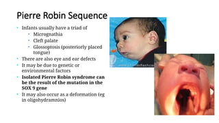 Approach to anomalies of Branchial Maldevelopment Lecture 2.pptx
