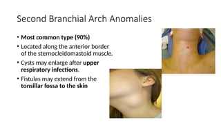 Approach to anomalies of Branchial Maldevelopment Lecture 2.pptx