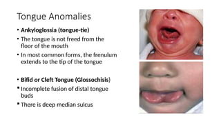 Approach to anomalies of Branchial Maldevelopment Lecture 2.pptx