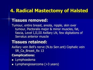Br ca lines of surg treatment the lect | PPT