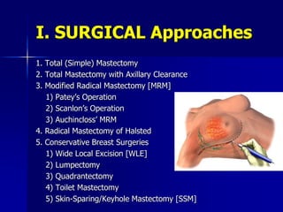 Br ca lines of surg treatment the lect | PPT