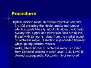 Br ca lines of surg treatment the lect | PPT