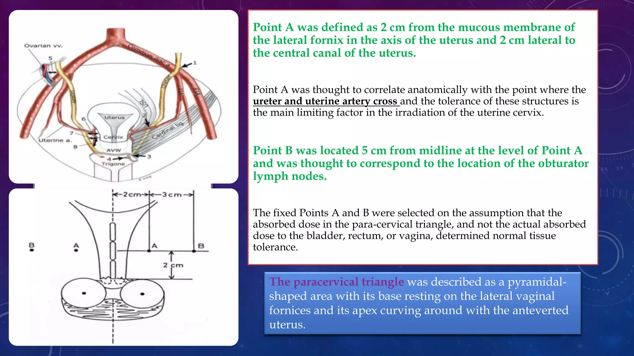 Brachytherapy in Carcinoma Cervix | PDF