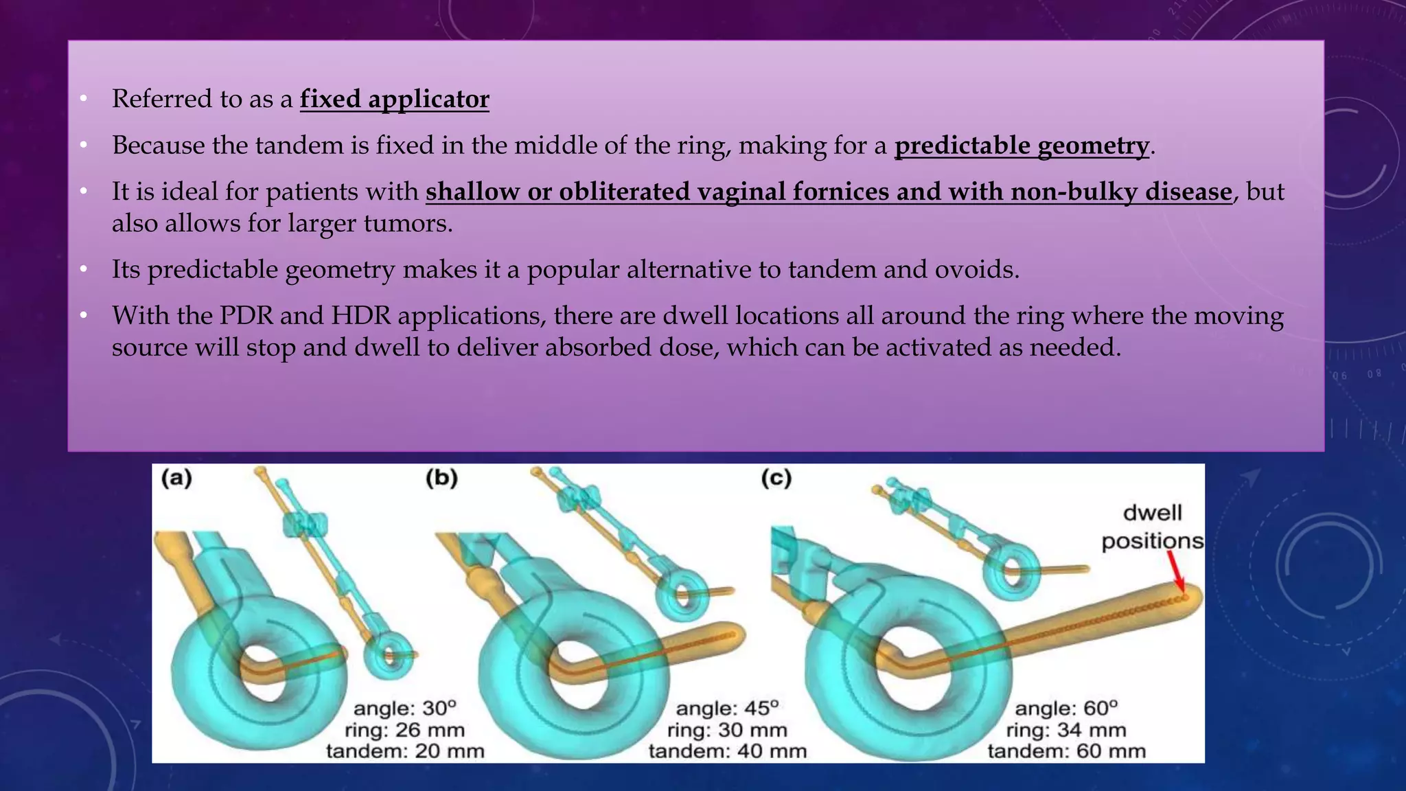 Brachytherapy in Carcinoma Cervix | PDF