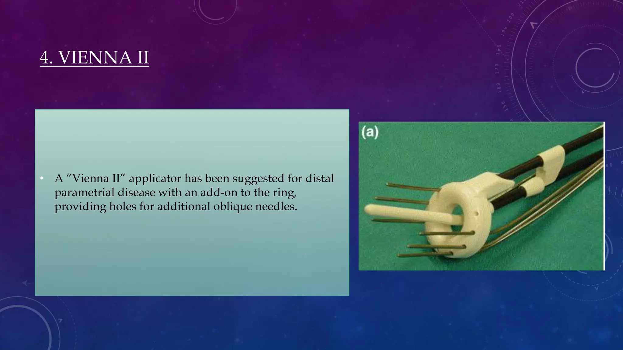 Brachytherapy in Carcinoma Cervix | PDF