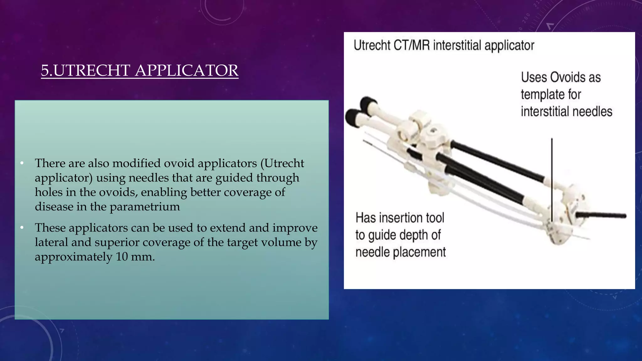 Brachytherapy in Carcinoma Cervix | PDF