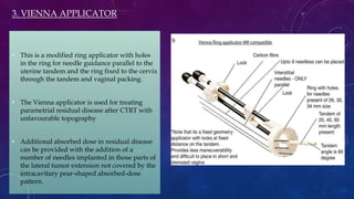 Brachytherapy in Carcinoma Cervix | PDF