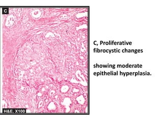 NON-NEOPLASTIC CONDITIONS of BREAST | PPTX