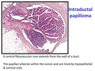 NON-NEOPLASTIC CONDITIONS OF BREAST | PPTX