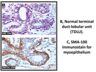NON-NEOPLASTIC CONDITIONS OF BREAST | PPTX