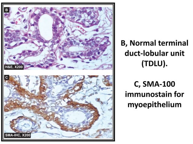 NON-NEOPLASTIC CONDITIONS OF BREAST | PPT