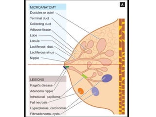 BREAST: NON-NEOPLASTIC CONDITIONS | PPT