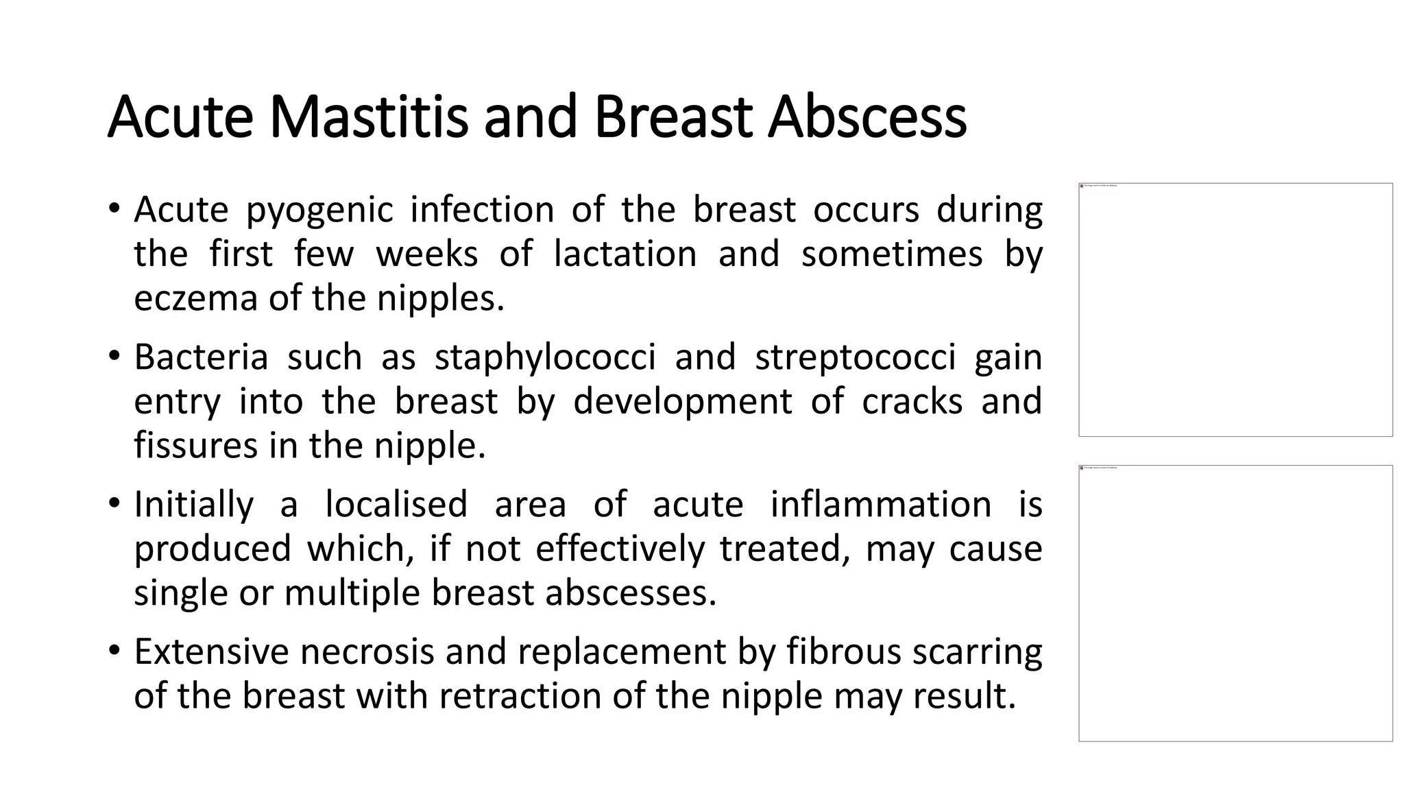 normal and malignant cytology of breast, cytology | PPTX