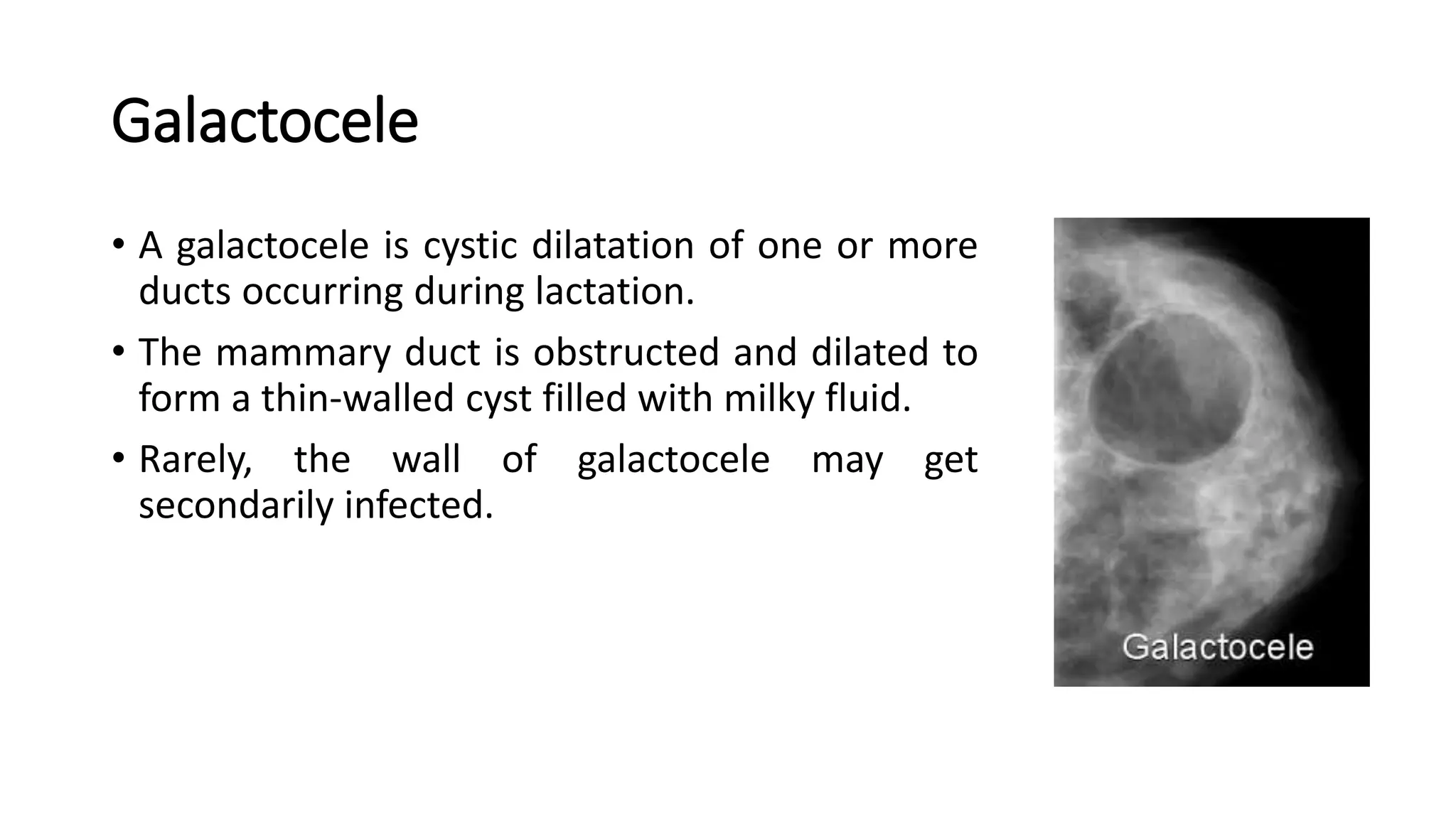 normal and malignant cytology of breast, cytology | PPTX