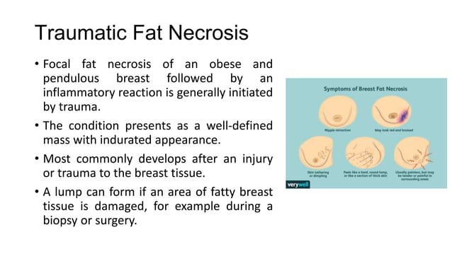 normal and malignant cytology of breast, cytology | PPTX