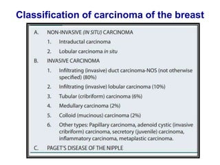 CARCINOMA OF THE BREAST | PPTX