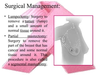 Oncology Nursing Topic Breast-Cancer.ppt
