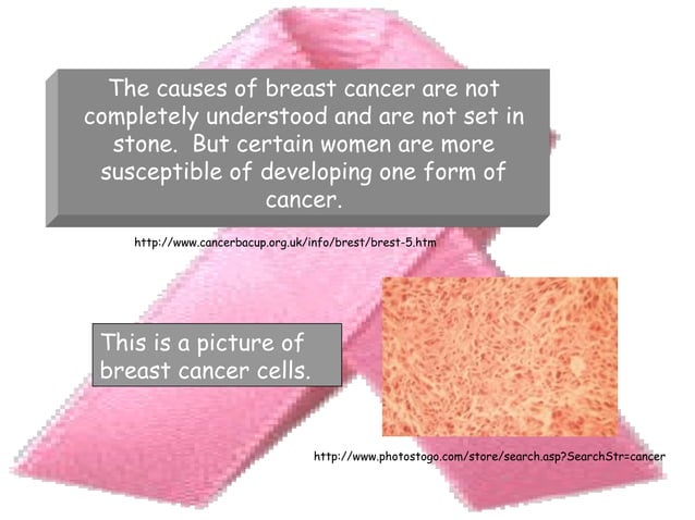 Oncology Nursing Topic Breast-Cancer.ppt