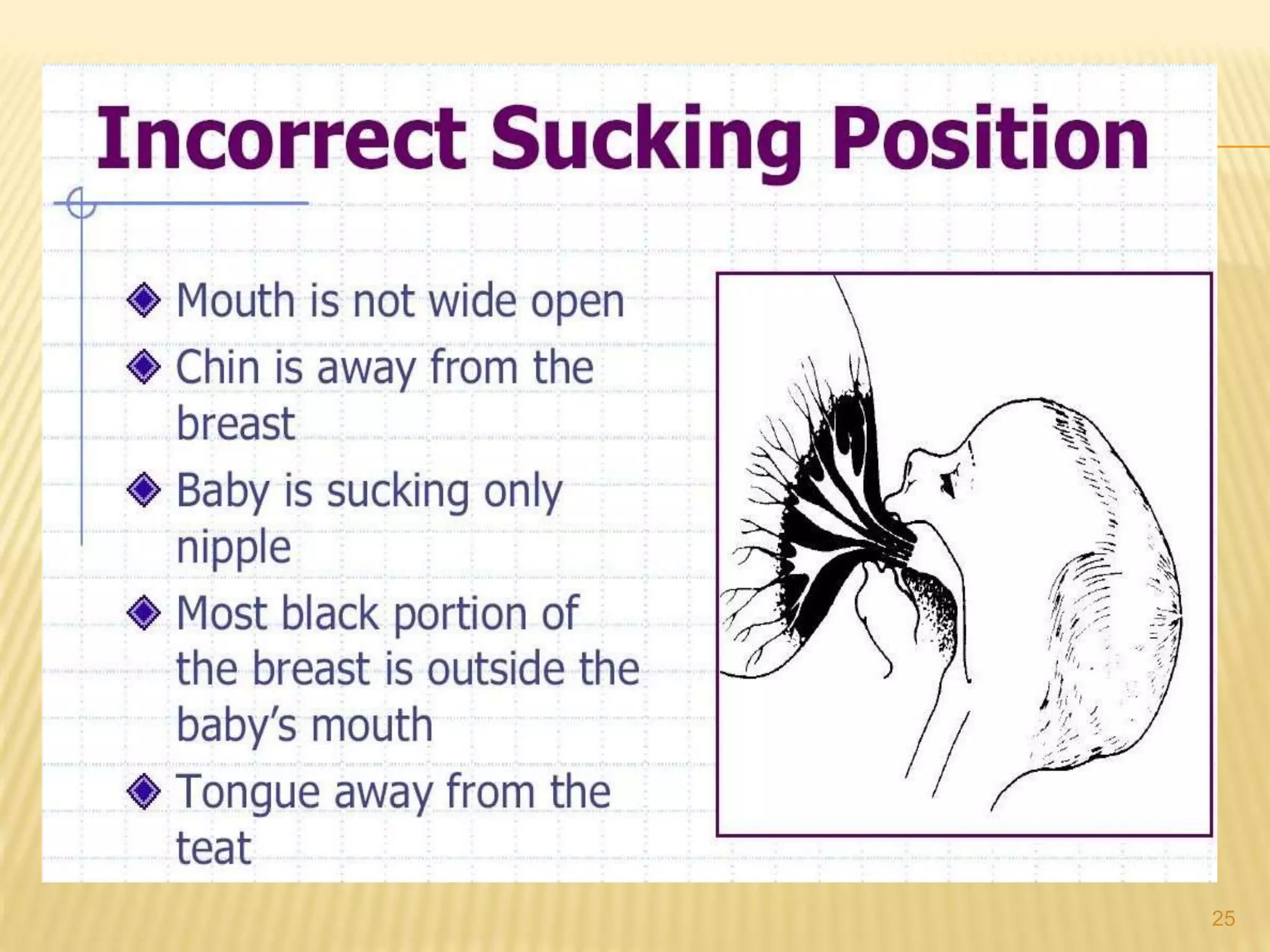 breast-feeding-techniques-and-positions-pediatric-nursing-ppt ...