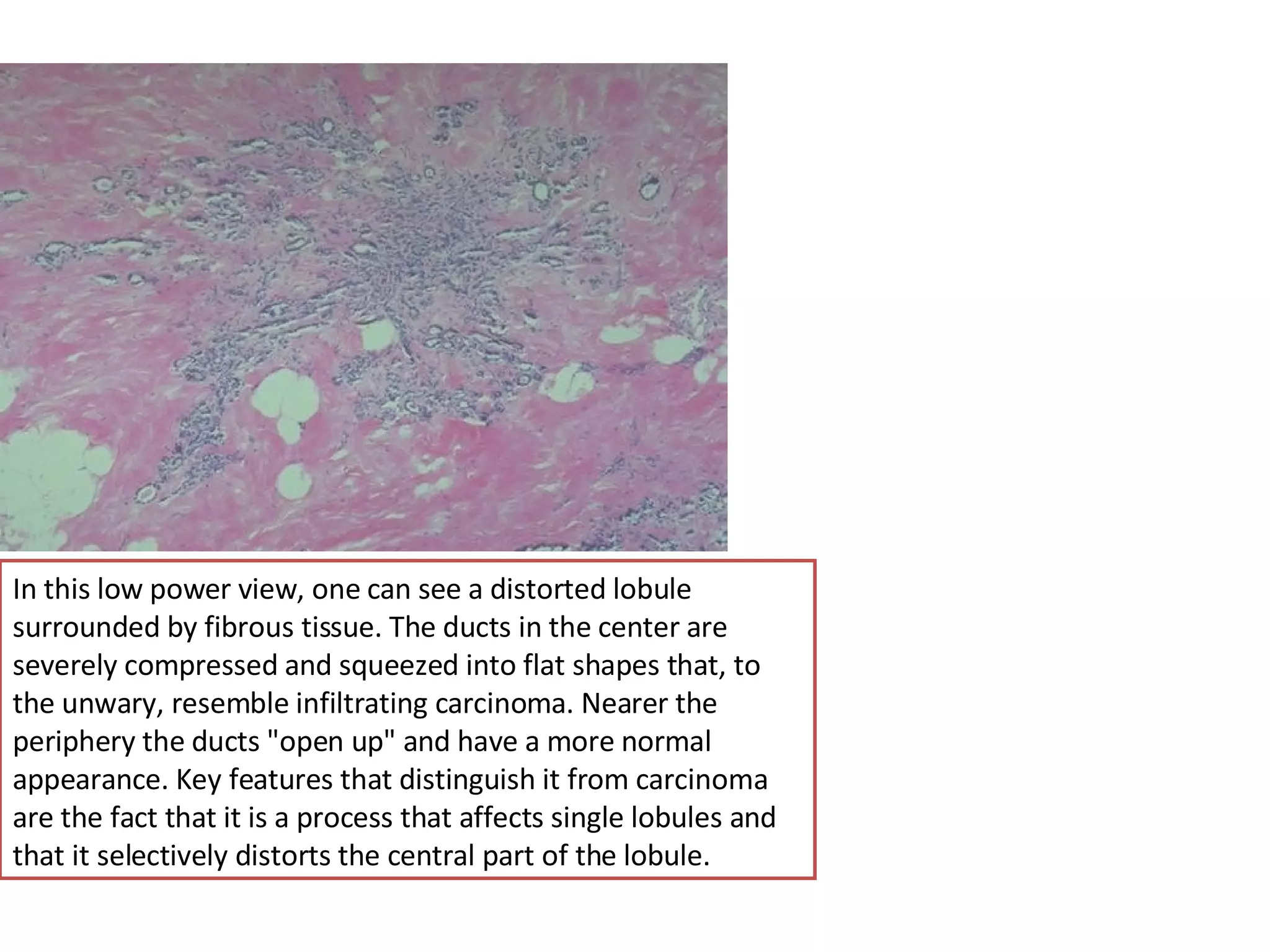 Breast Histology | PPT
