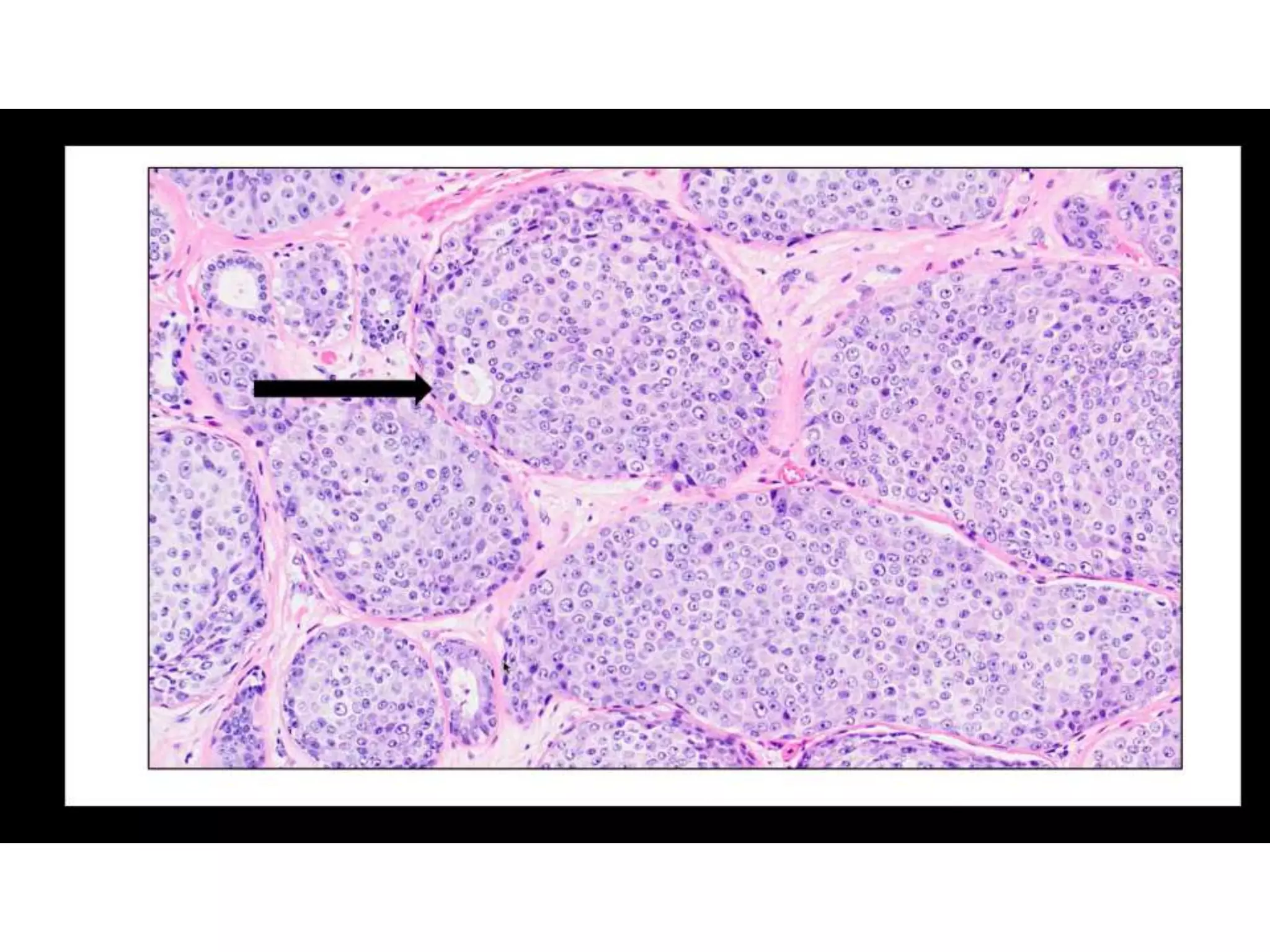 Breast-IHC panels.pptx