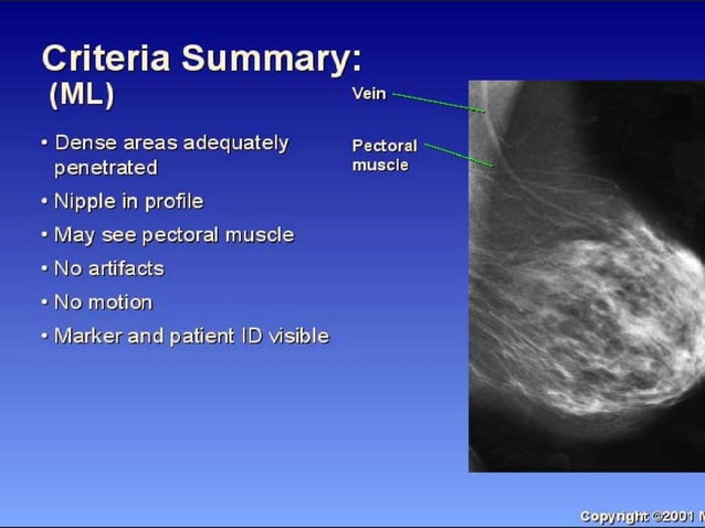 Breast imaging modalities | PPTX
