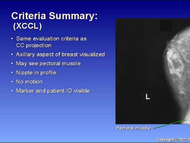 Breast imaging modalities