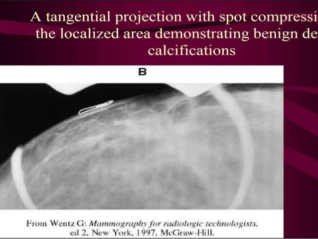 Breast imaging modalities