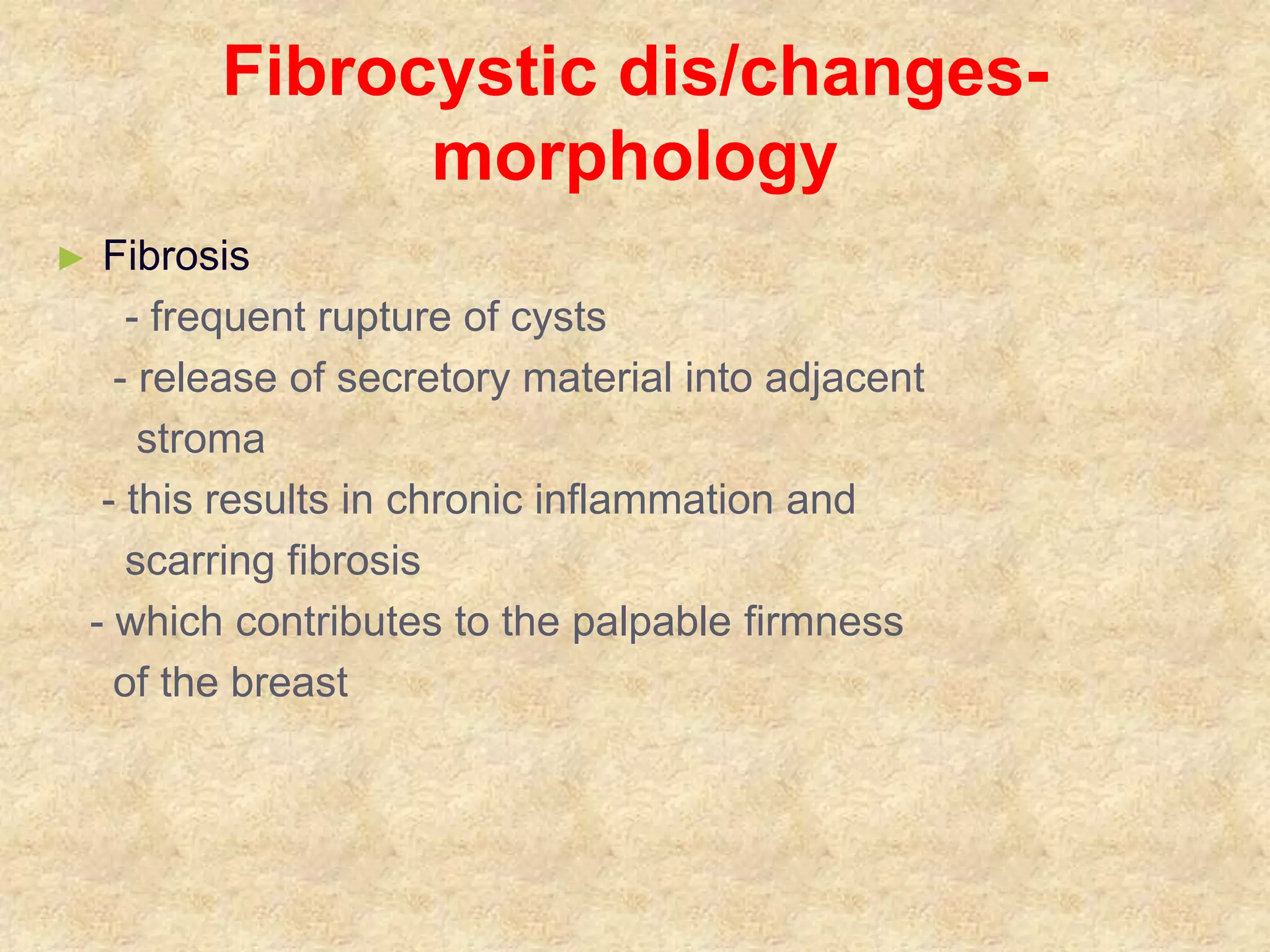 Breast inflammatory, proliferative lesions for MBBS | PPTX
