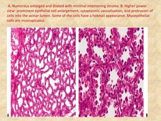 Breast introduction 1 | PPTX