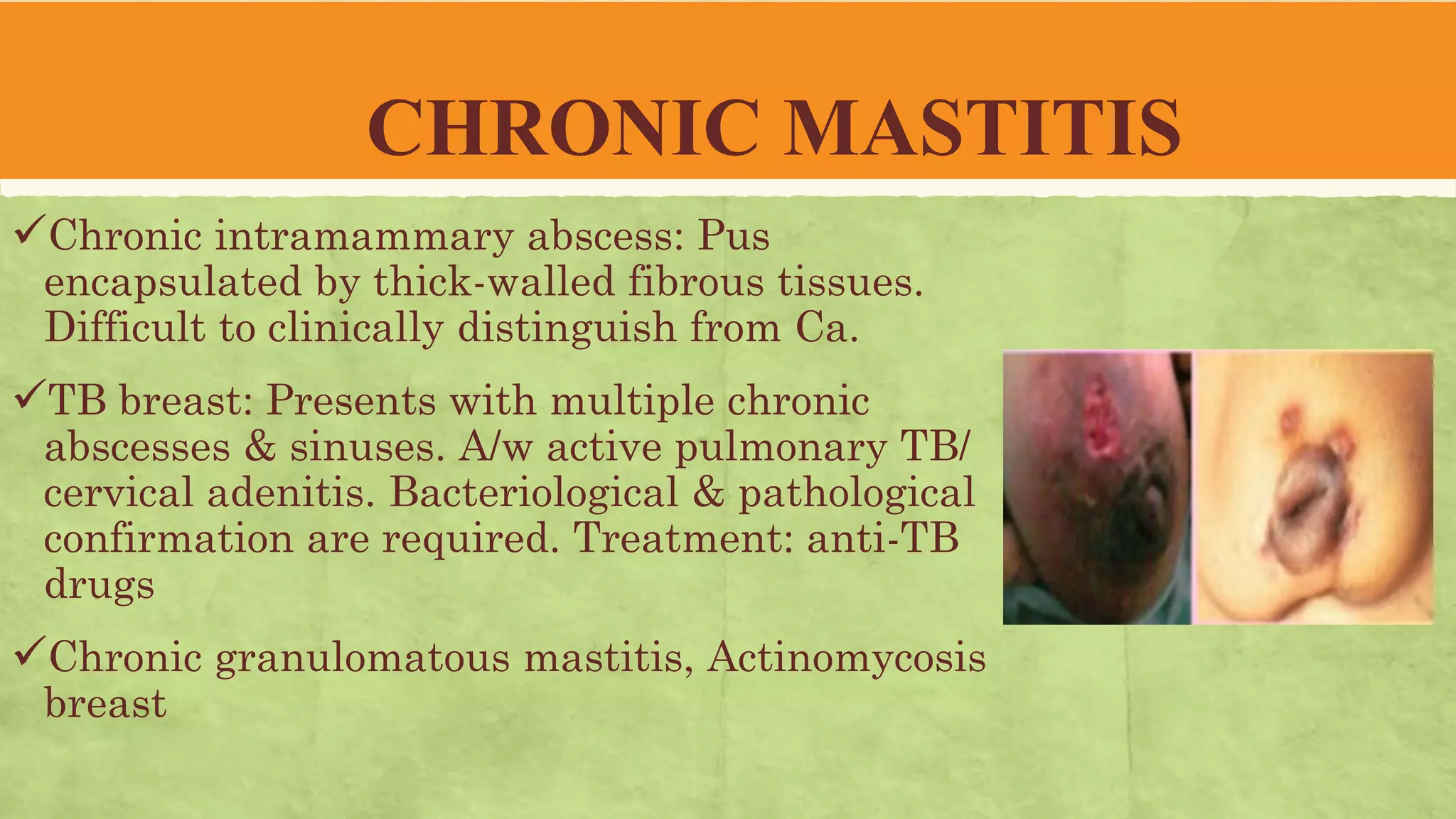 Breast- introduction, benign diseases and carcinoma breast | PDF