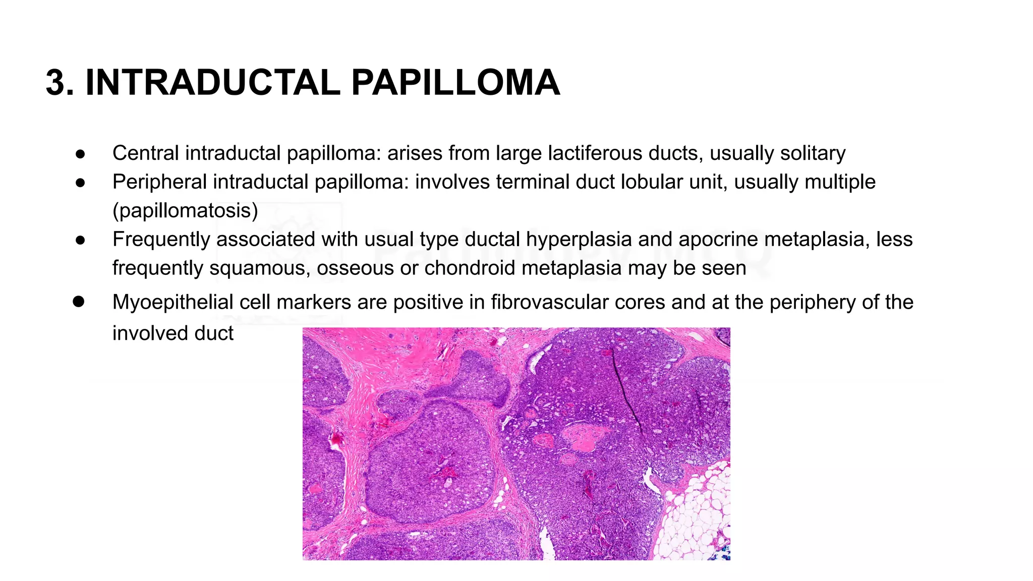 BREAST-PATHOLOGY-benign-proliferative-lesions.pdf