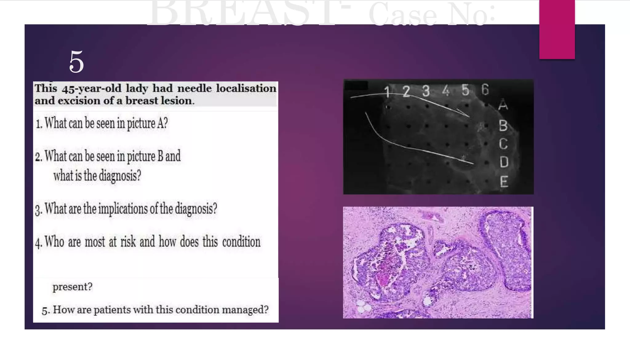 Breast / PBL Case Scenario Triggers | PPTX