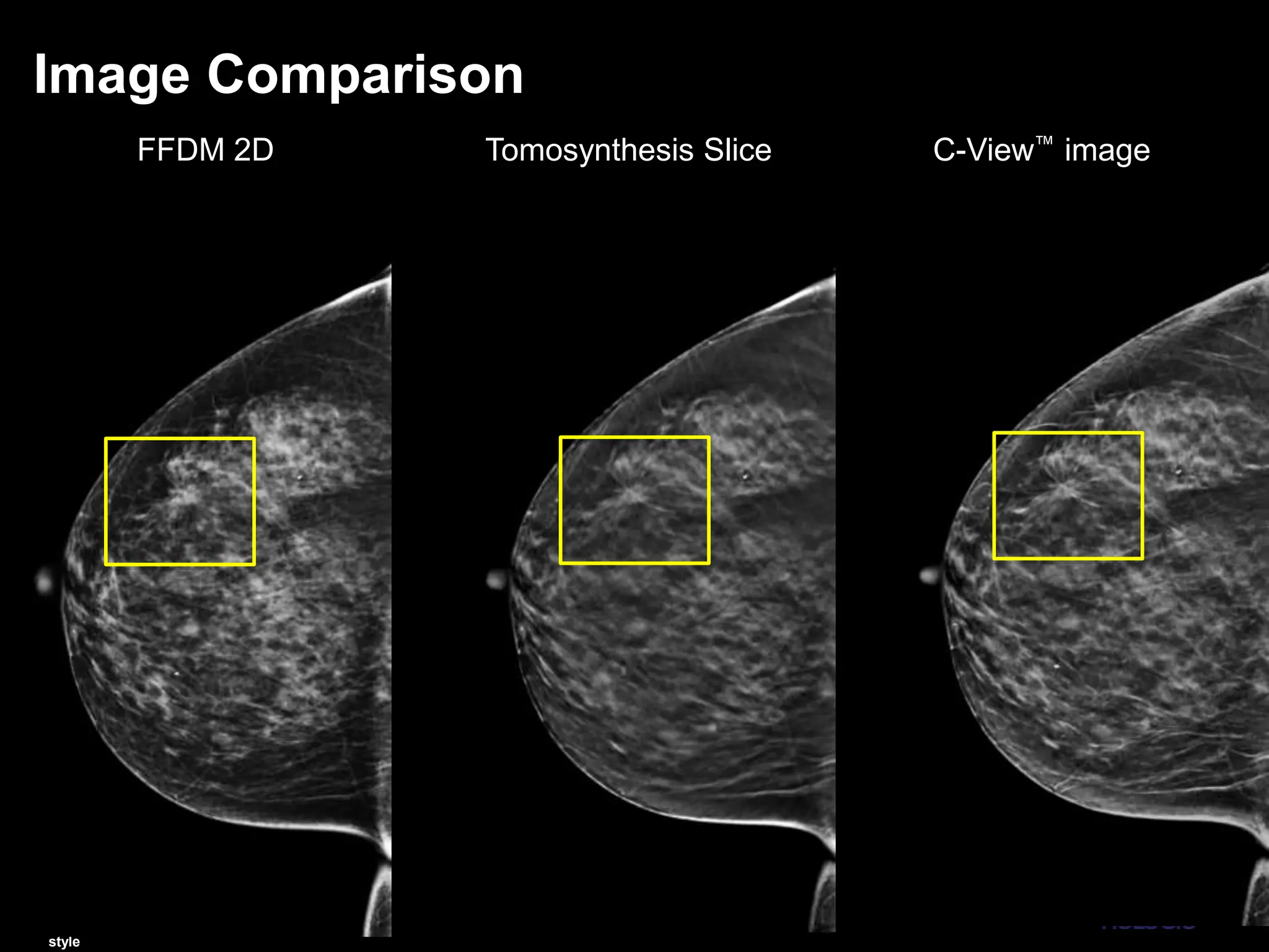 Breast-Tomosynthesis-for-MDs-PPT.pptx