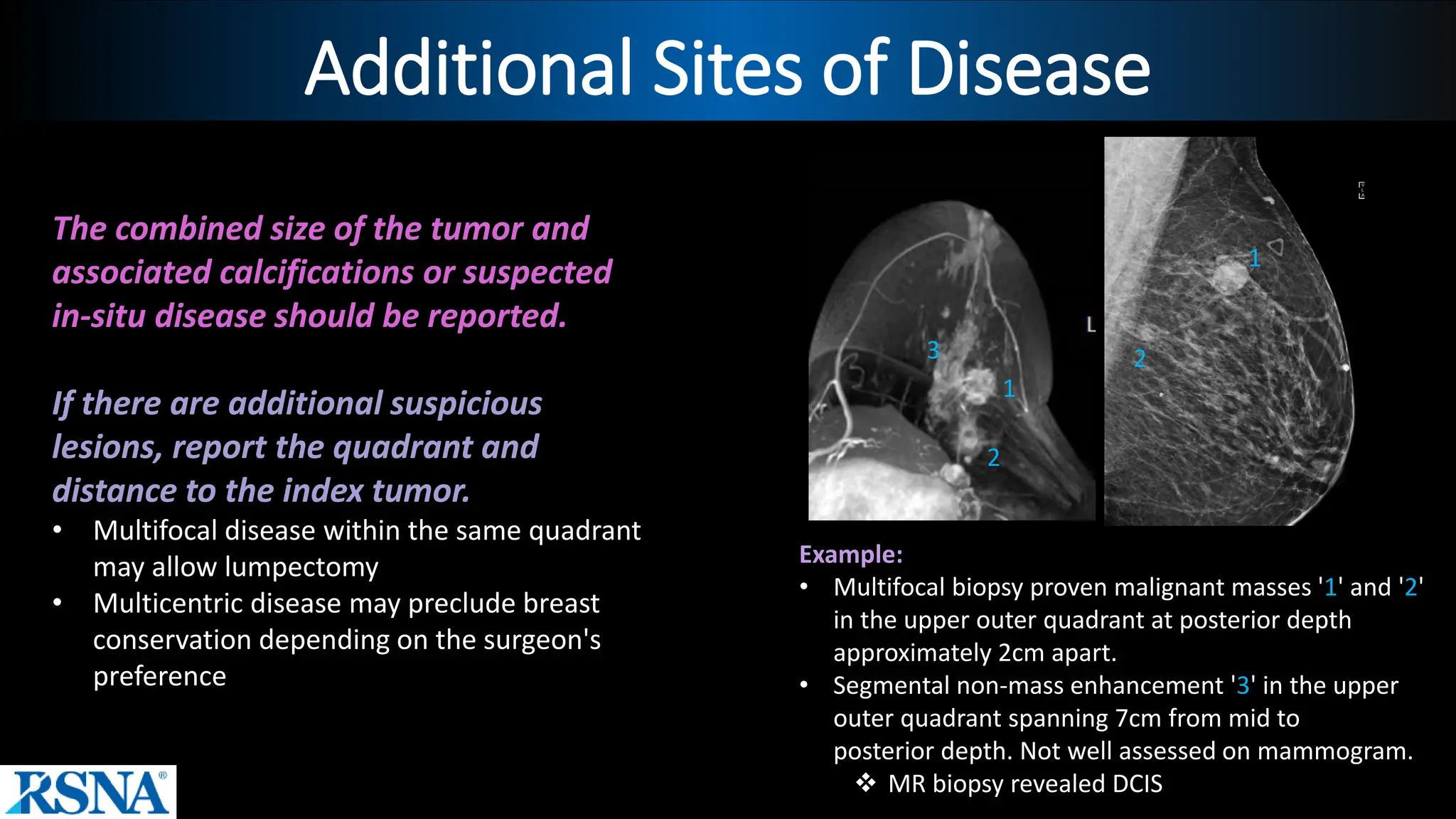 Breast-Tumor-Board-FINAL.pdf for imaging students | PPT