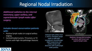 Breast-Tumor-Board-FINAL.pdf for imaging students | PPT